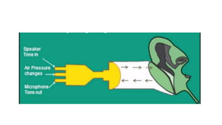 Acoustic immittance | PPTX