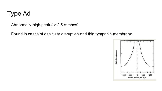 Acoustic immittance | PPTX