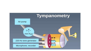 Acoustic immittance | PPTX