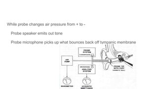 Acoustic immittance | PPTX