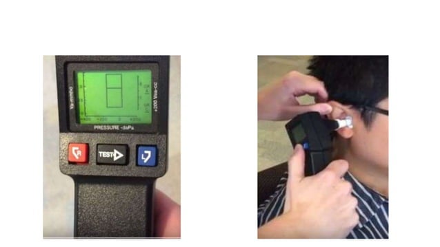 Acoustic immittance | PPTX