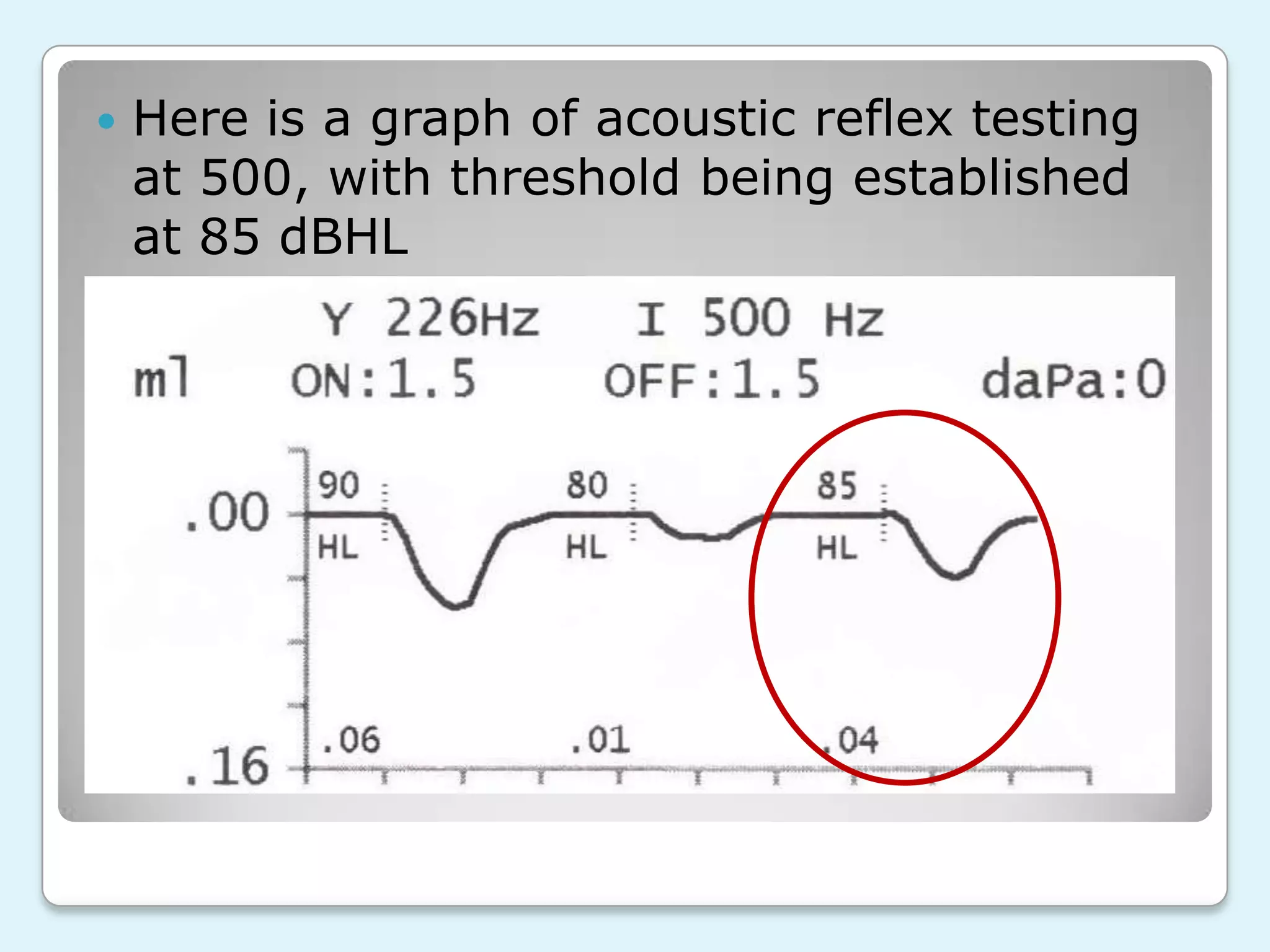 Acoustic Immittance Measurements | PPTX