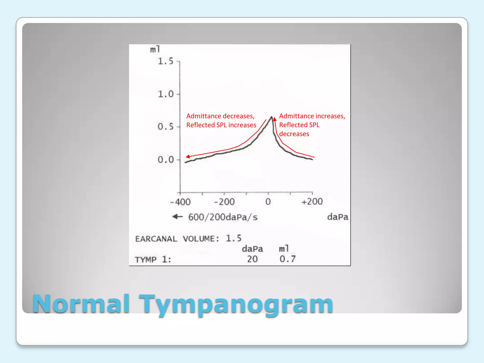 Acoustic Immittance Measurements | PPTX