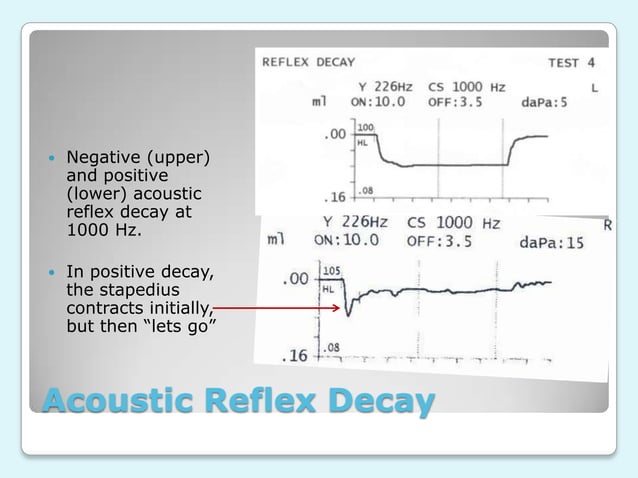 Acoustic Immittance Measurements | PPTX | Digital Audio | Computer ...