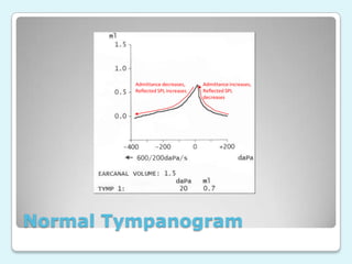 Acoustic Immittance Measurements | PPTX