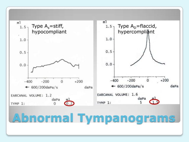 Acoustic Immittance Measurements | PPTX | Digital Audio | Computer ...