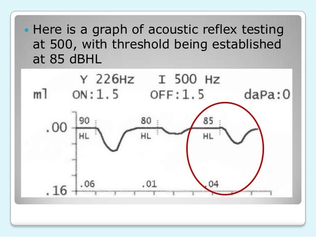 Acoustic Immittance Measurements
