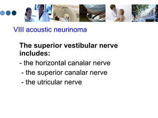 Acoustic neuroma | PPT