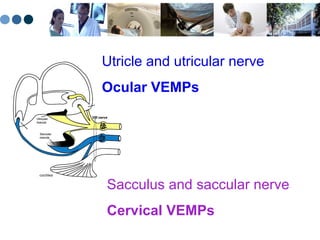 Acoustic neuroma | PPT