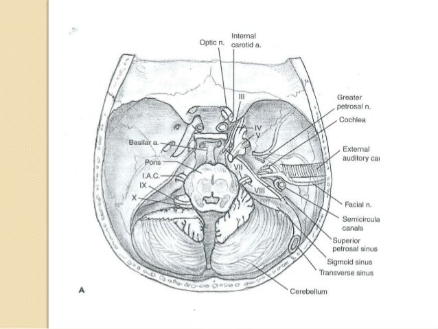 Acoustic Neuroma
