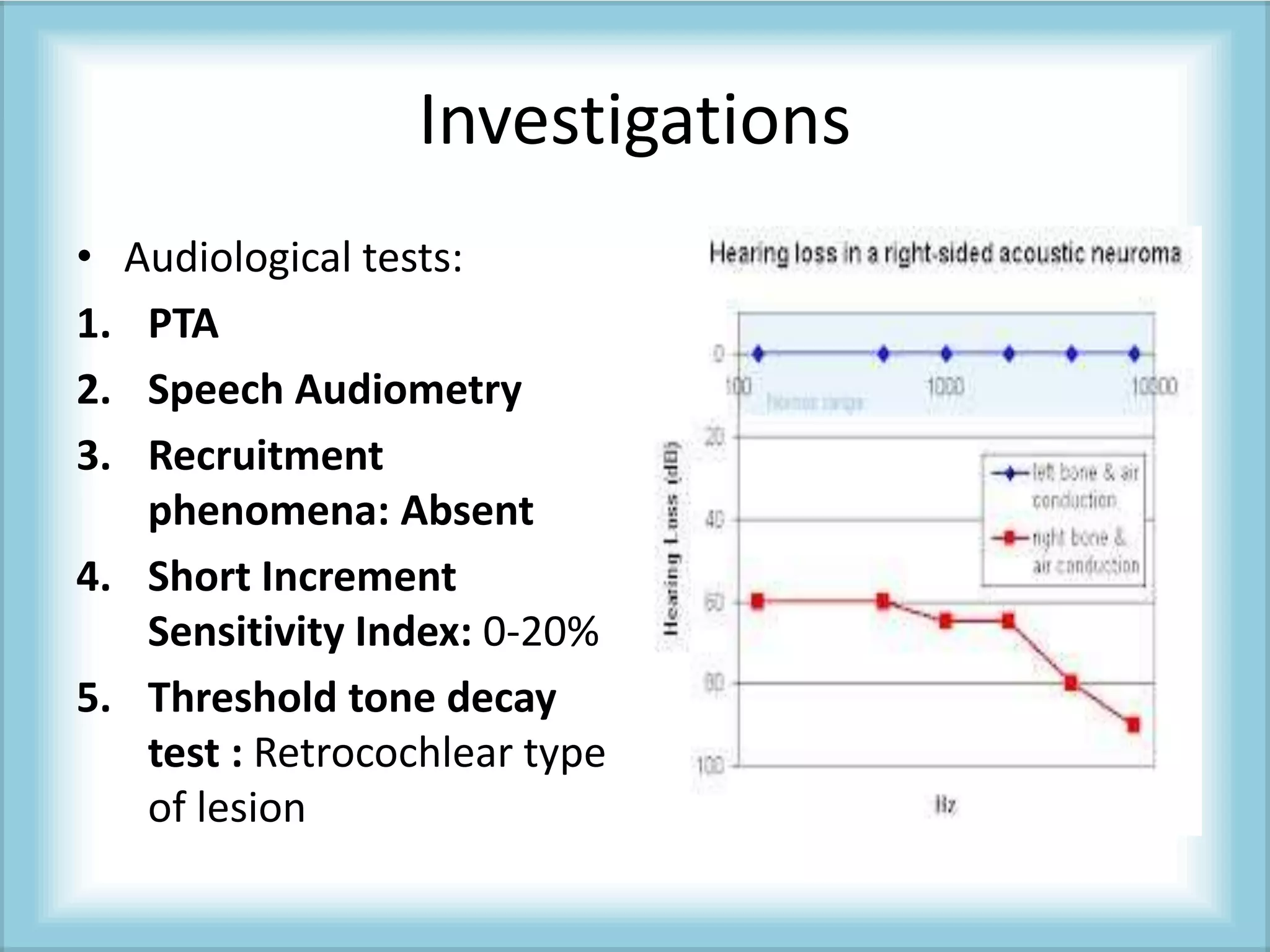 Acoustic neuroma | PPTX