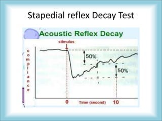 Acoustic neuroma | PPT