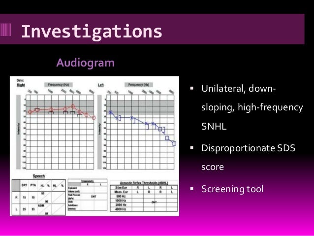 Acoustic neuroma