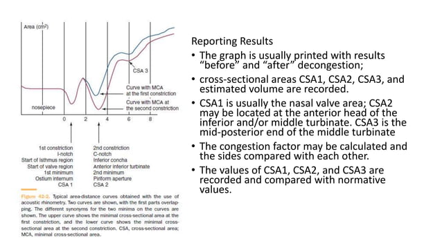 Acoustic rhinometry | PPT
