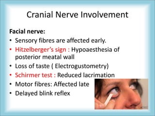 Acoustic schwannoma (Dr. Mahesh) | PPTX | Ear, Nose and Throat ...