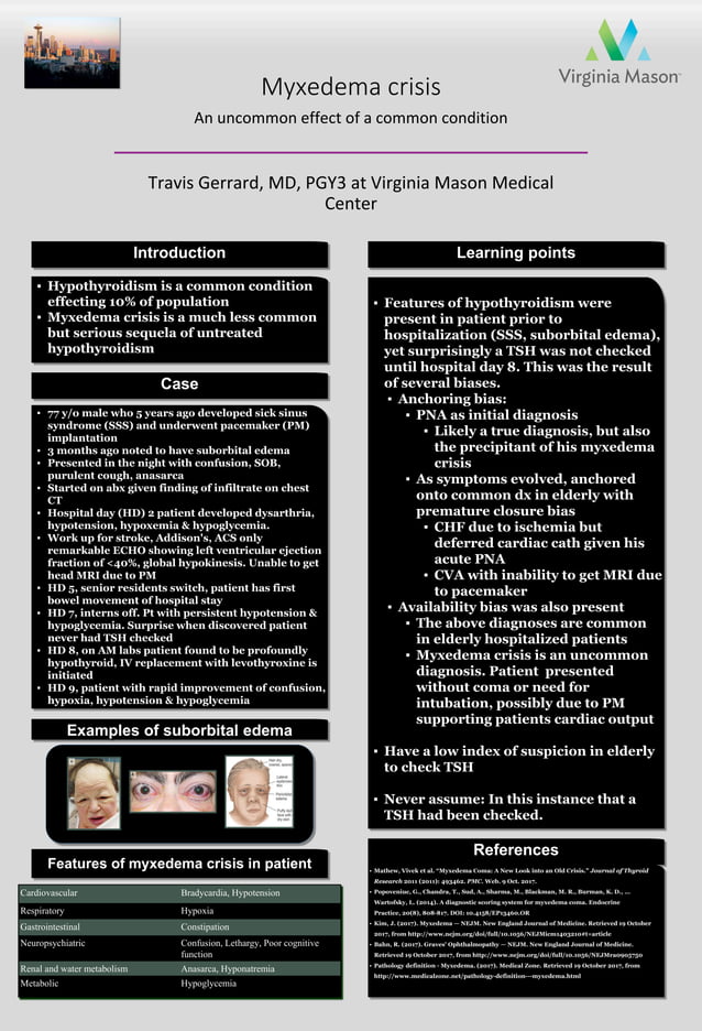 Myexedema crisis | PDF