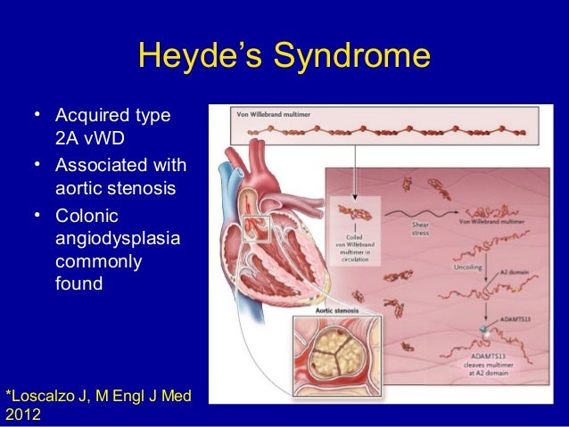 Acquired Bleeding Disorders