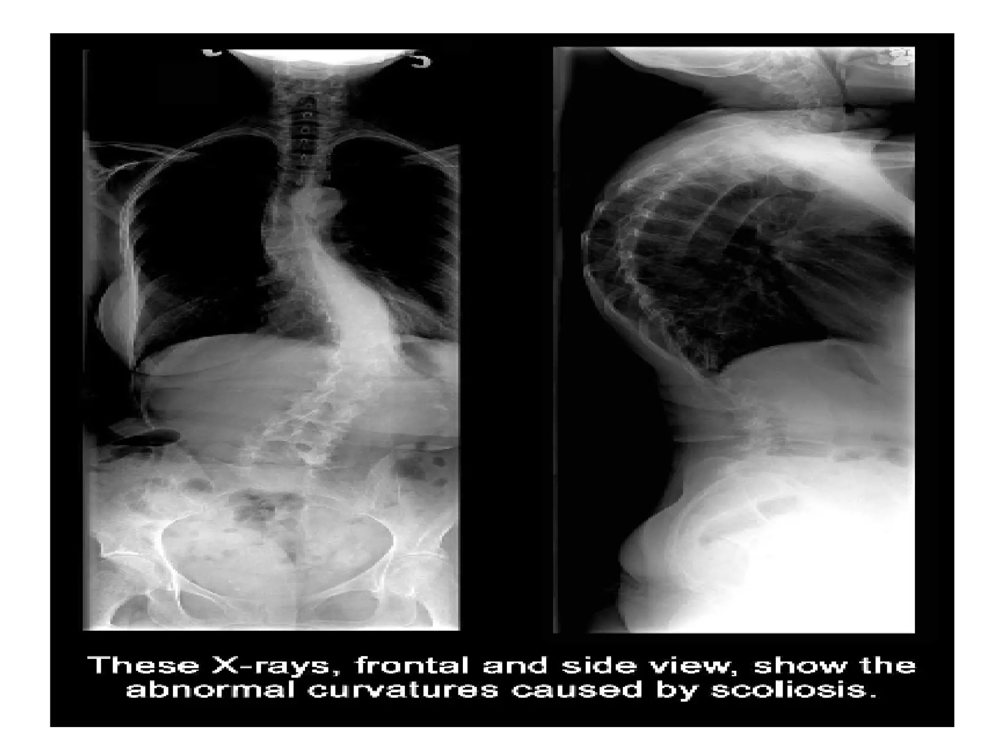 Acquired Bone Deformities | PPT