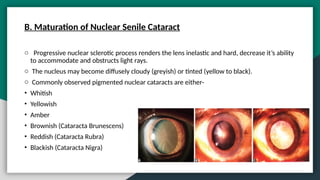 Acquired Cataracts: Causes, Symptoms, and Management.pptx