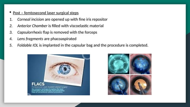 Acquired Cataracts: Causes, Symptoms, and Management.pptx
