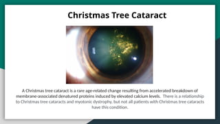 Acquired Cataracts: Causes, Symptoms, and Management.pptx