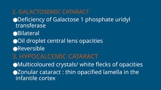 Acquired Cataract classification ,risk, mechanism and stages_mbbs.pptx