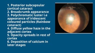 Acquired Cataract classification ,risk, mechanism and stages_mbbs.pptx