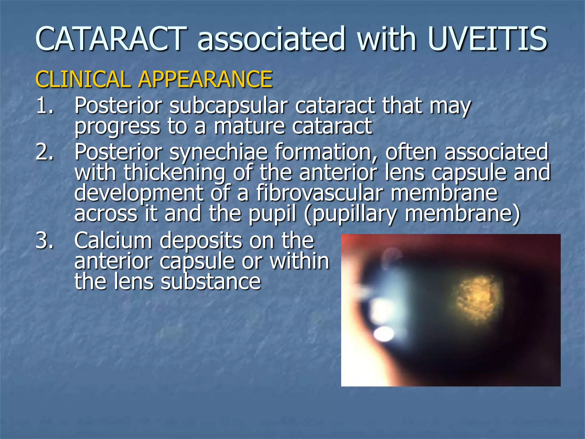 Acquired cataracts.ppt