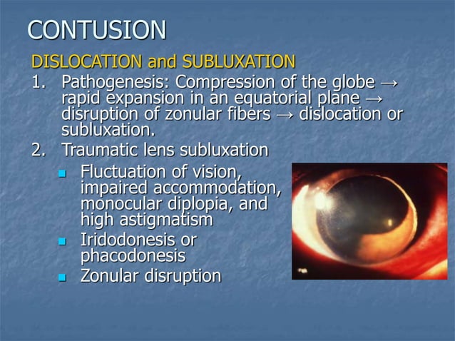 Acquired cataracts.ppt