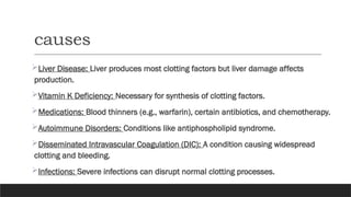 Acquired Coagulation Disorders: Types, Causes, Symptoms, and Management ...