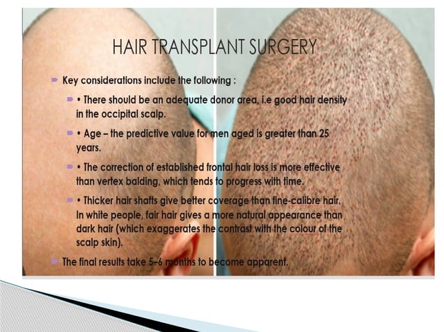 Acquired disorders of hair shaft by amna.pptx