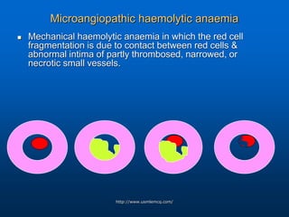 Acquired haemolytic anaemia | PPTX