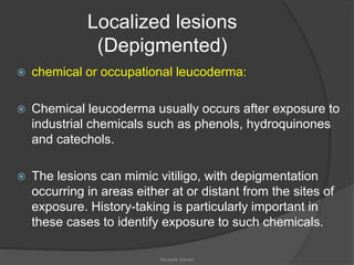 Acquired Hypopigmentation in Adults | PPTX