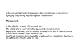 Acquired lacrimal disorders, DCR, DCT | PPTX