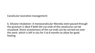 Acquired lacrimal disorders, DCR, DCT | PPTX