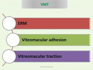 Acquired macular diseases | PPTX
