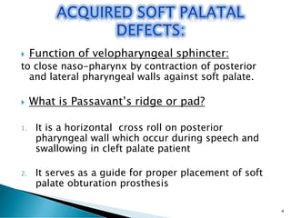 Acquired maxillary defects copy removeable | PDF