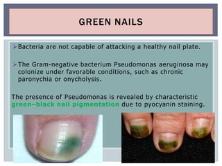 Acquired nail dis part | PPT