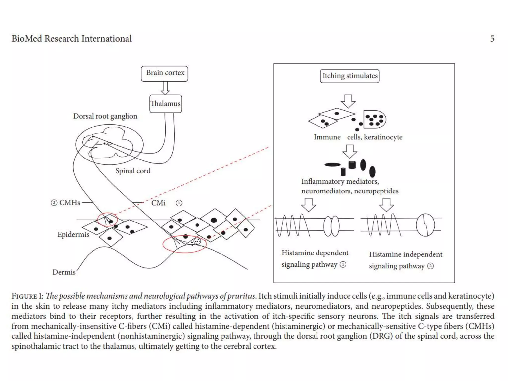 Acquired perforating dermatosis and lichen amyloidosis | PPTX