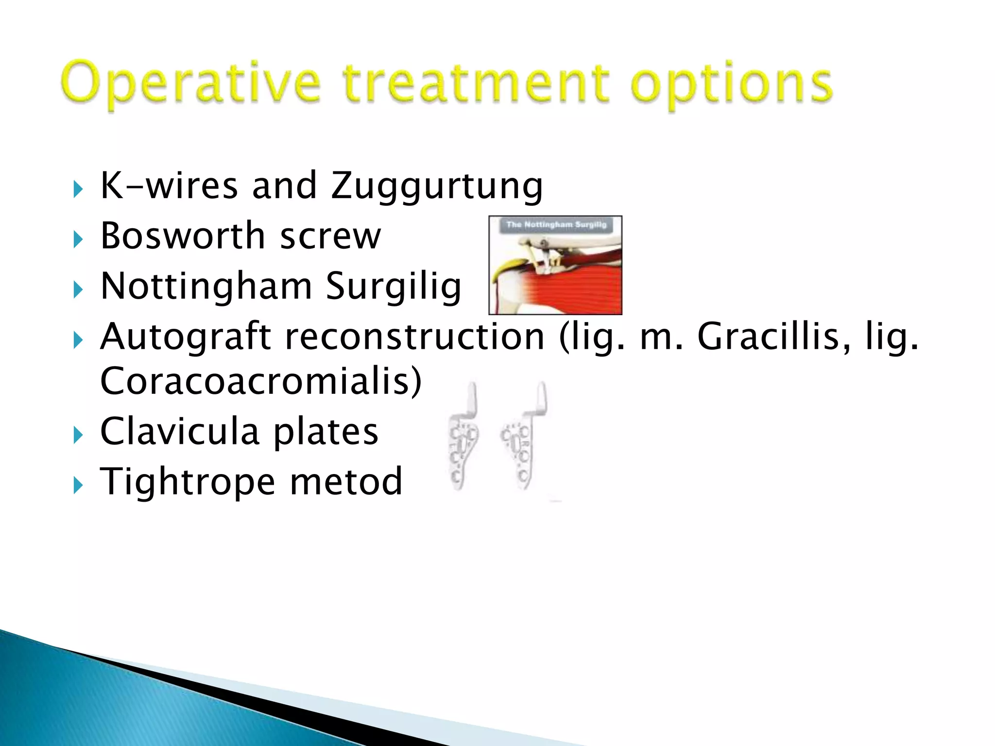 Aacromio clavicular reconstruction | PPT