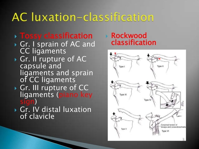 Aacromio clavicular reconstruction | PPT