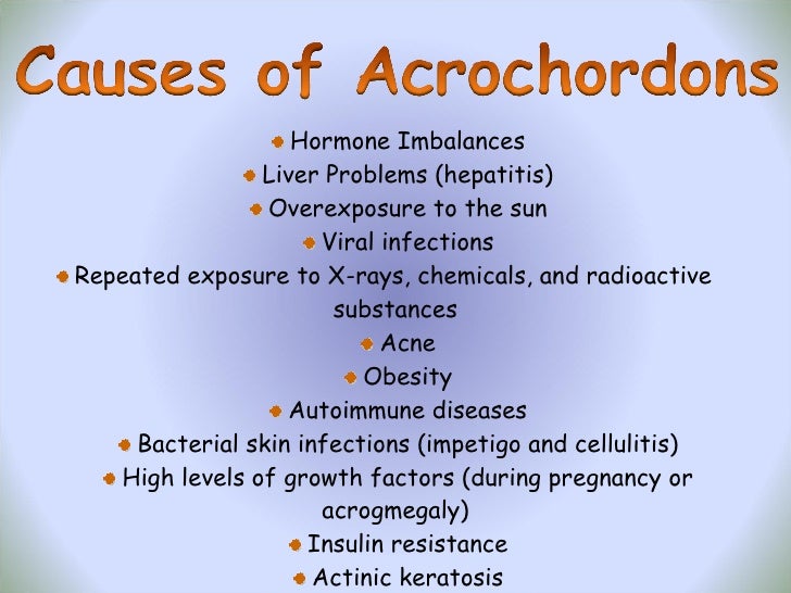 acrochordons - DrBeckmann