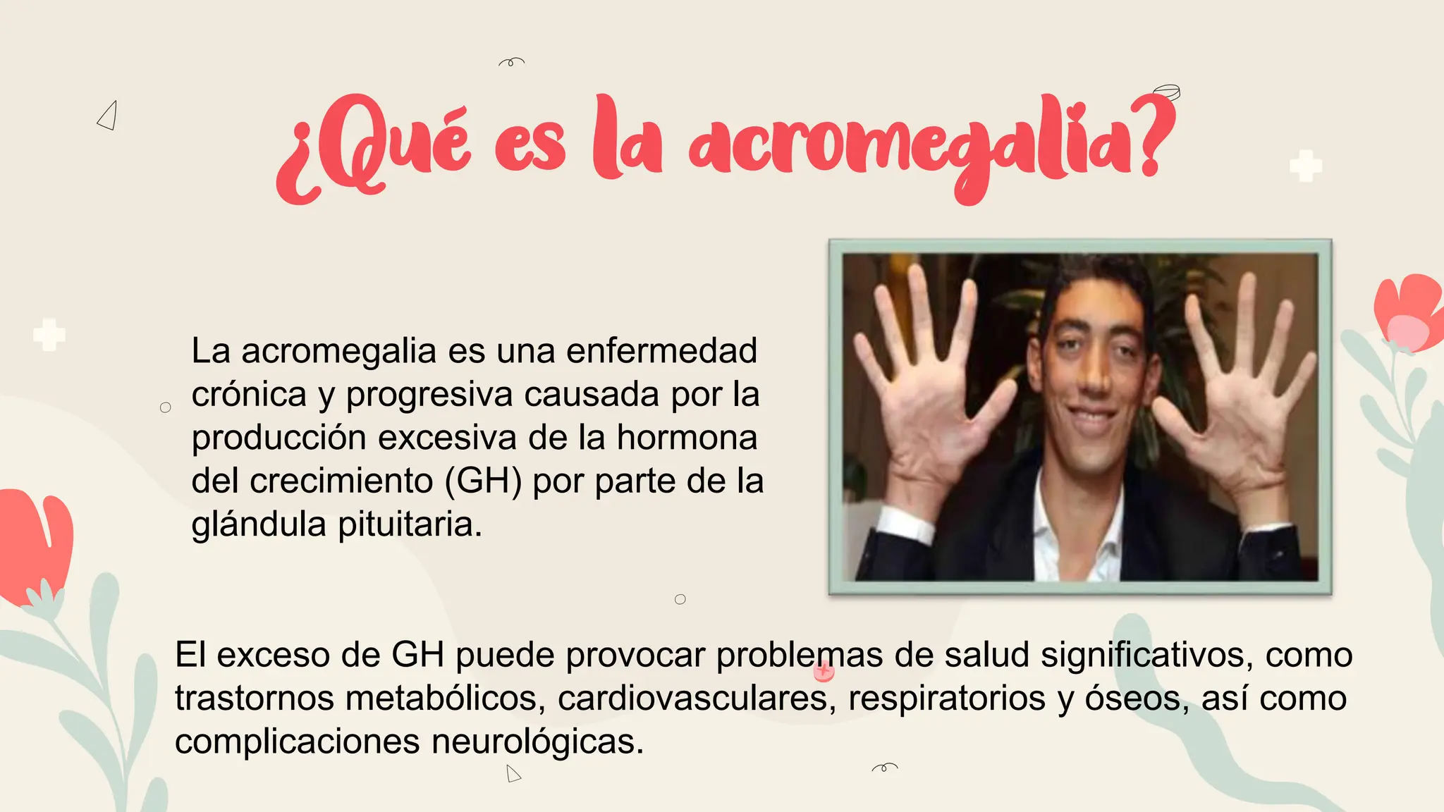 Acromegalia.pptx causas tratamiento y dx | PPTX