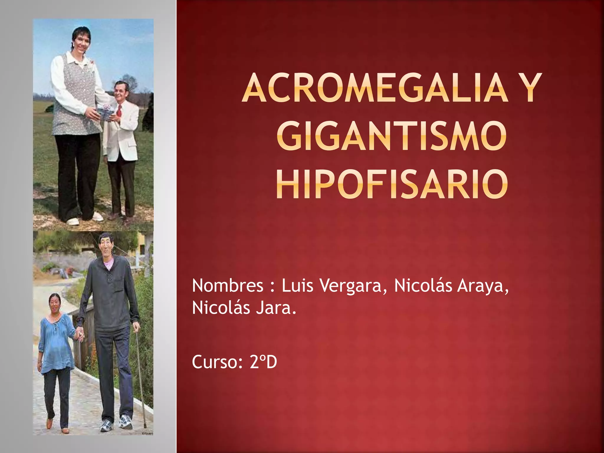 Acromegalia y gigantismo hipofisario biologia | PPT