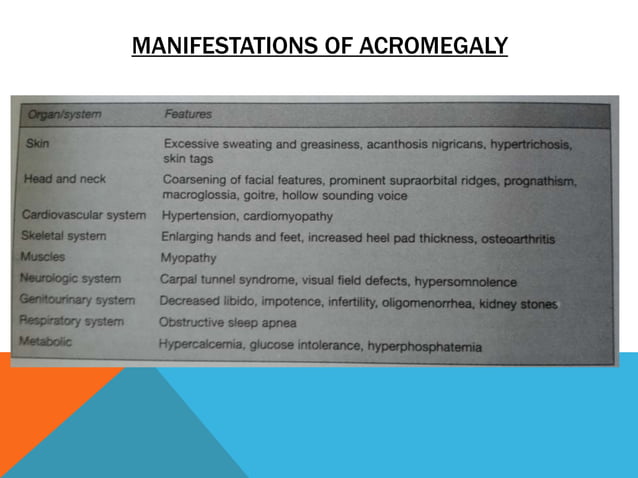 Acromegaly-pathogenesis | PPTX
