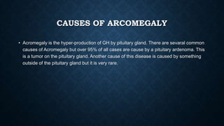 Acromegaly | PPTX