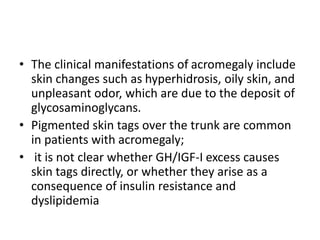 Acromegaly | PPTX