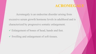 Acromegaly | PPTX