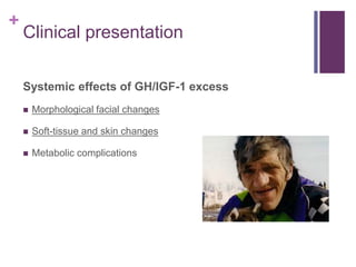 Clinical Case (Acromegaly) | PPTX