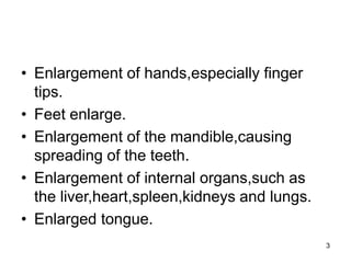 Acromegaly.ppt